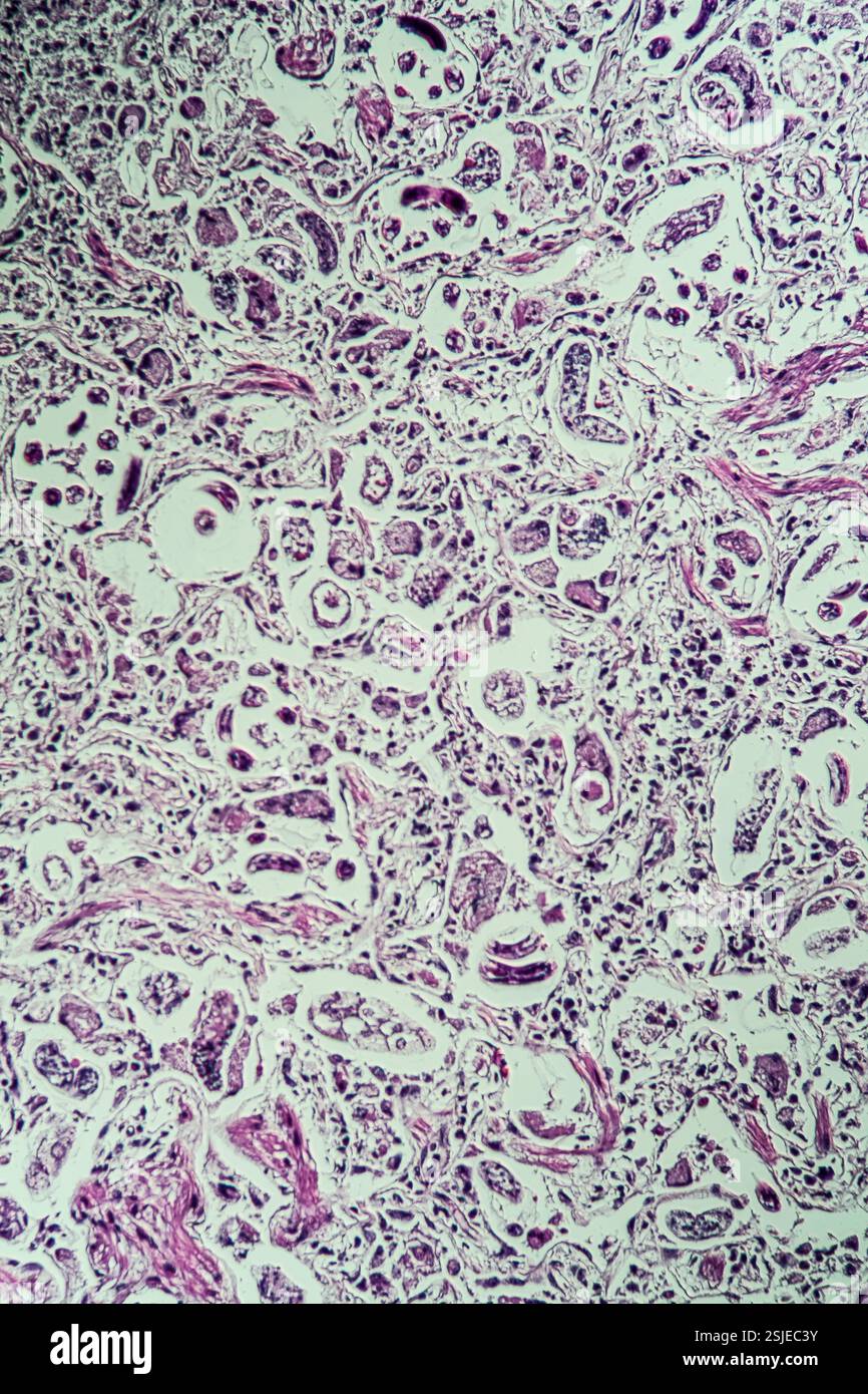 Lungworm in tissue under the microscope 200x hi-res stock photography ...