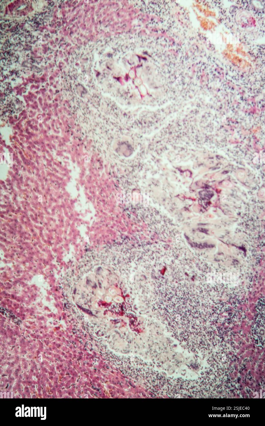 Parasite eggs in tissue under the microscope 100x Stock Photo - Alamy