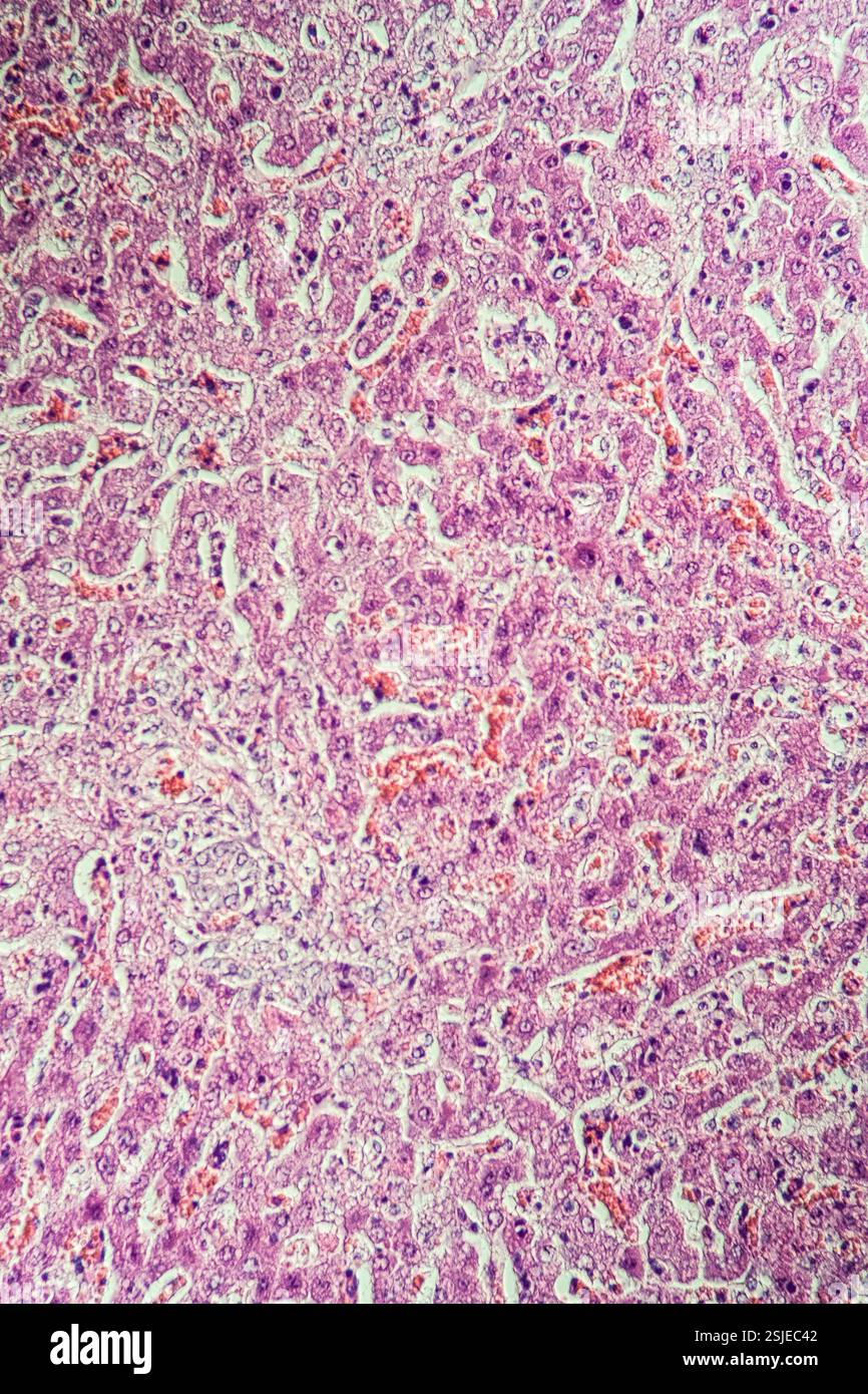 Hedgehog kidney after shock under the microscope 200x Stock Photo - Alamy