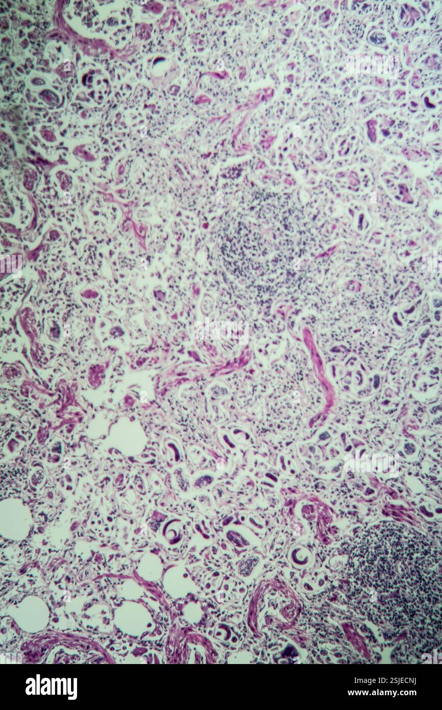 Lungworm in tissue under the microscope 100x Stock Photo - Alamy