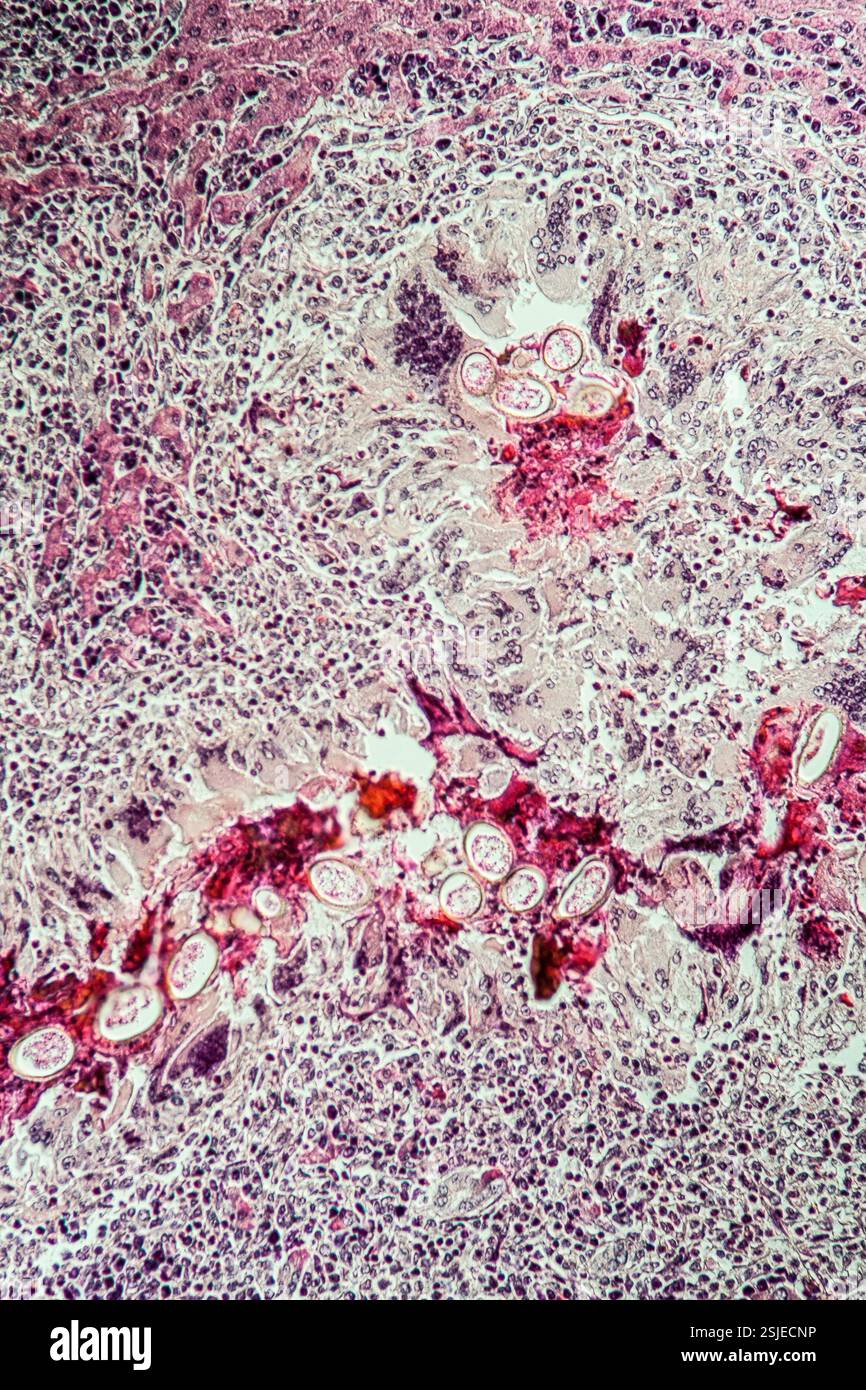 Parasite eggs in deer tissue under the microscope 200x Stock Photo - Alamy