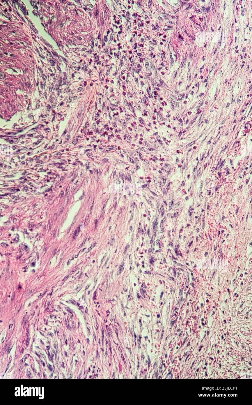 Gallbladder tissue under the microscope 200x Stock Photo - Alamy