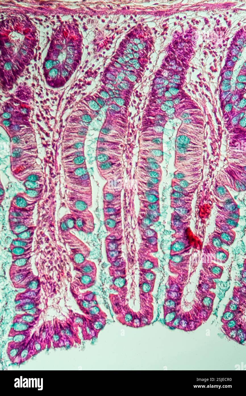Small intestine with intestinal villi under the microscope 200x Stock ...