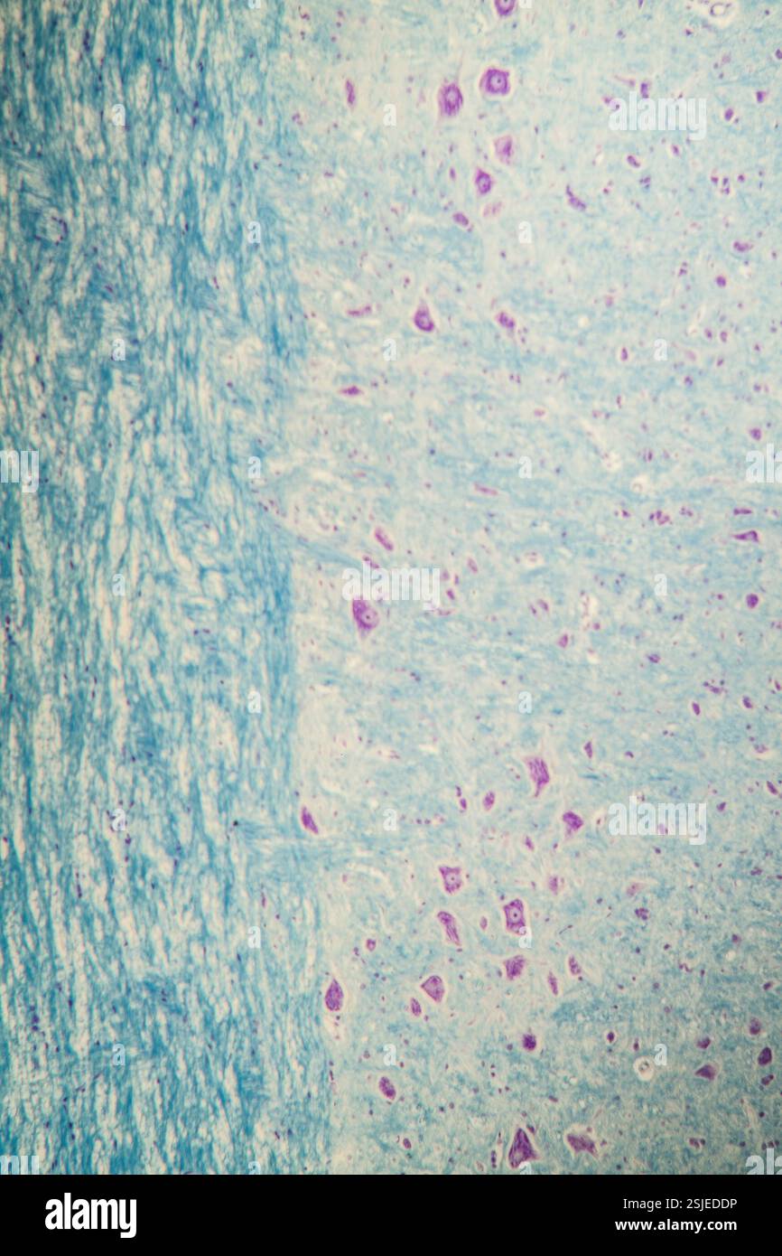 Nerve cells under the microscope 100x Stock Photo - Alamy