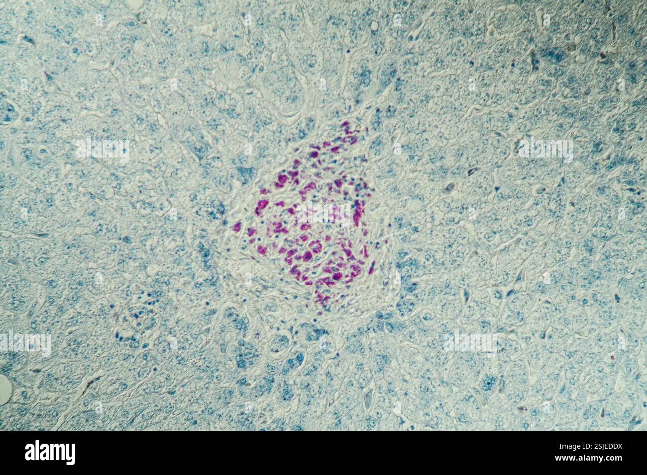 Virus bacteria under microscope hi-res stock photography and images - Alamy