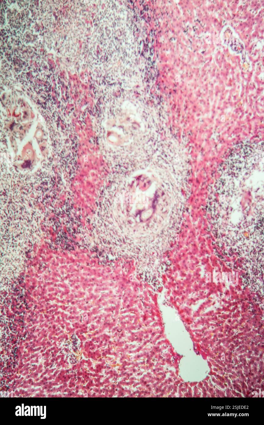 Parasite eggs in tissue under the microscope 100x Stock Photo - Alamy