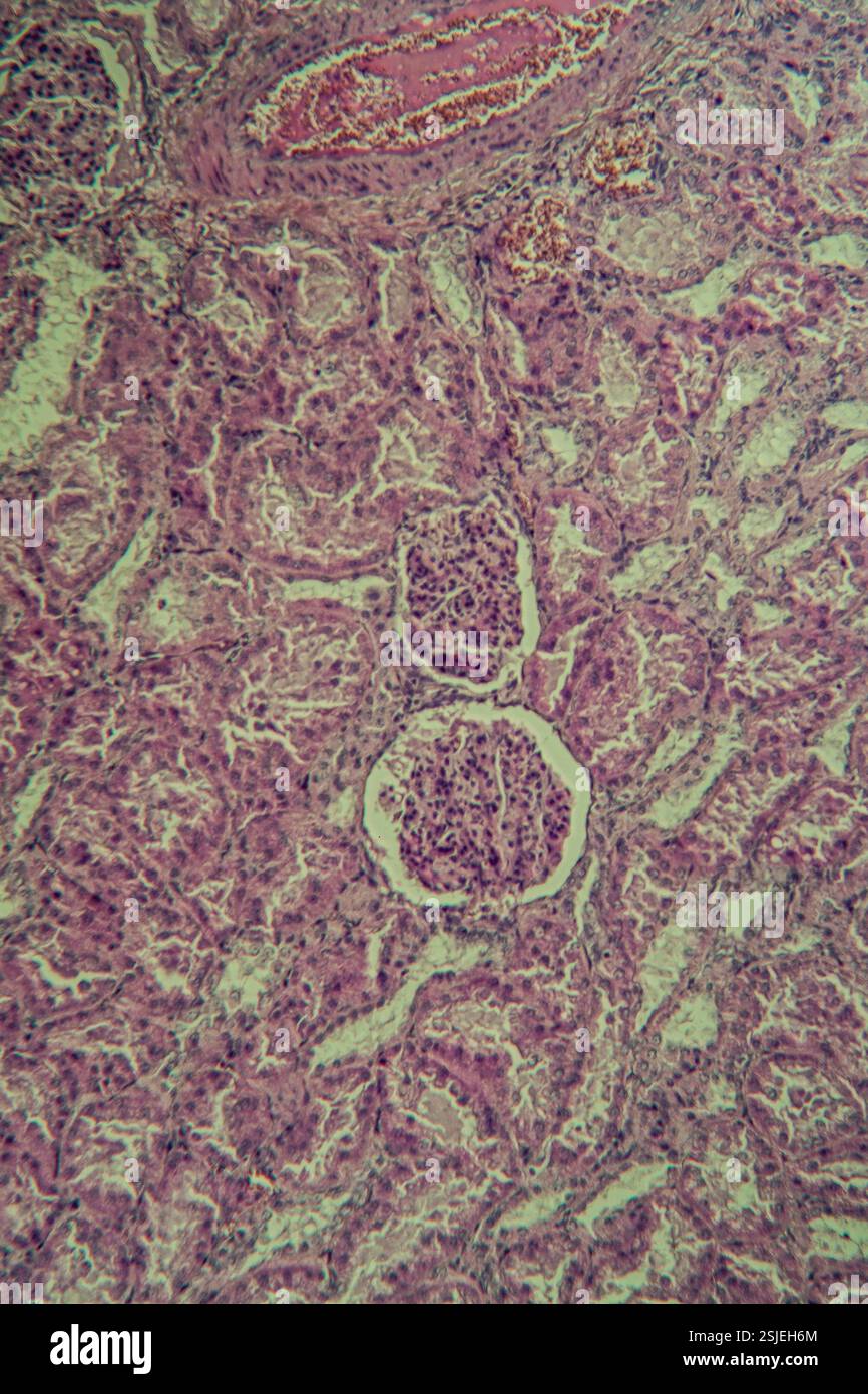 Cross section of the kidney 100x Stock Photo - Alamy