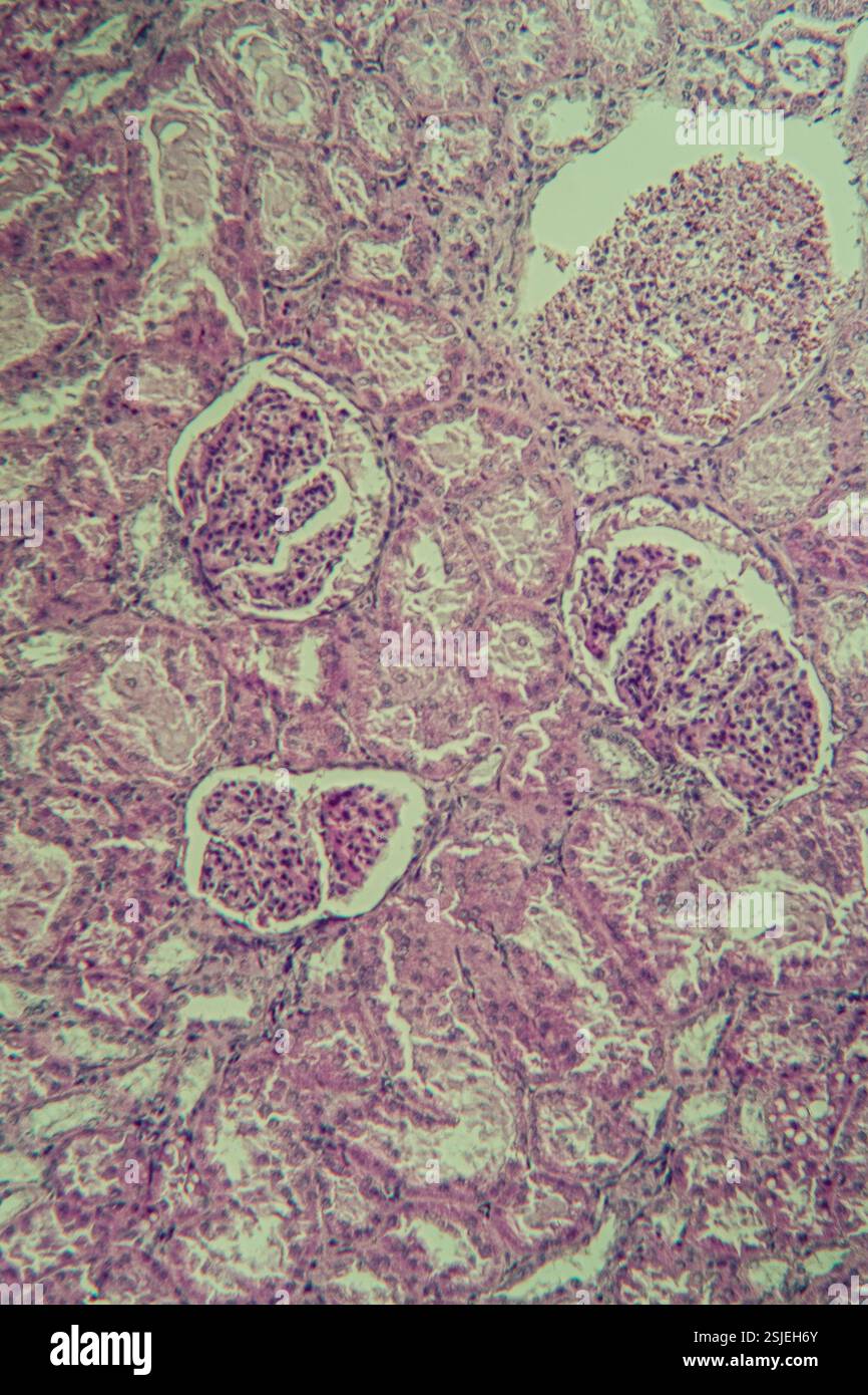 Cross section of the kidney with renal corpuscles 100x Stock Photo - Alamy