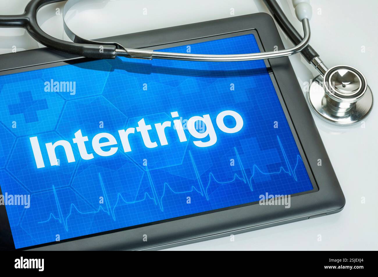 Intertrigo hi-res stock photography and images - Alamy
