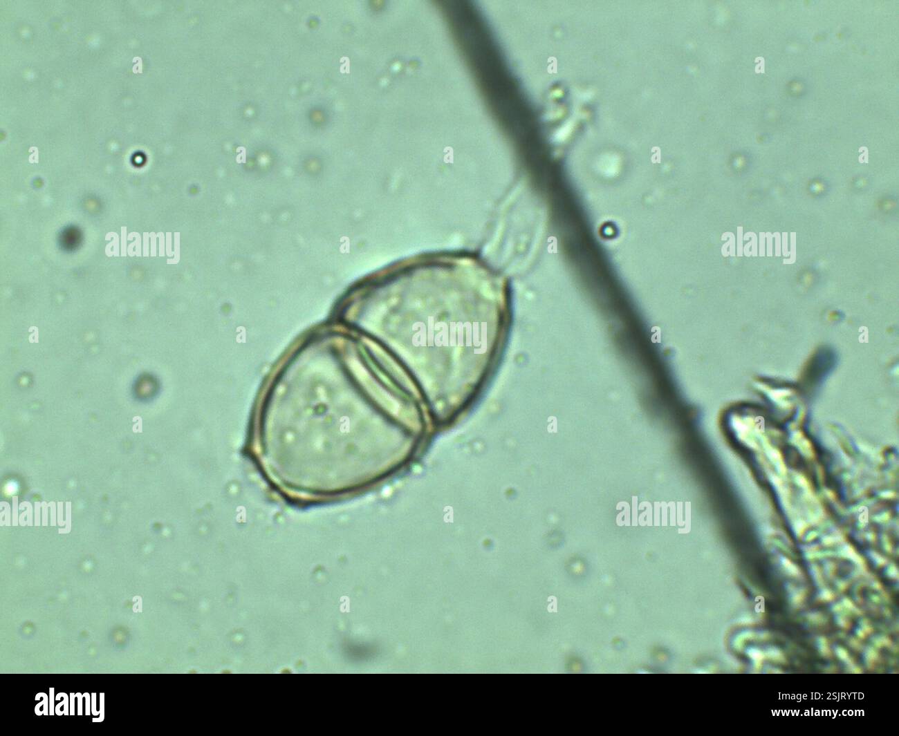 cedar rusts (Gymnosporangium), Fungi, Herndon, VA 20170, USA, On ...