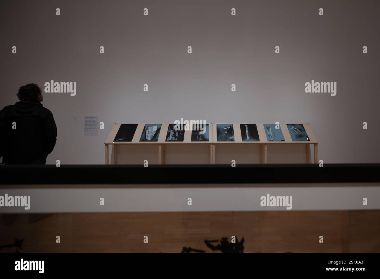 London, UK, 11th February 2025, Donald Rodney: Visceral Canker ...