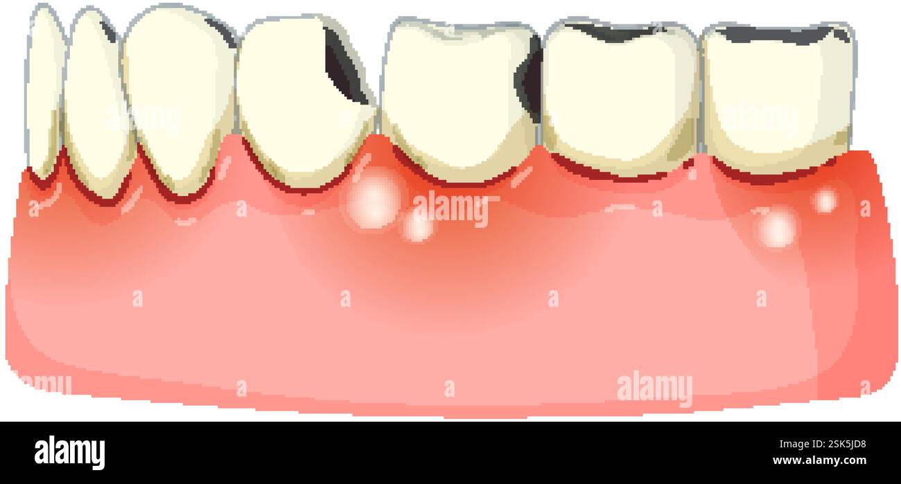 Gum health awareness hi-res stock photography and images - Alamy