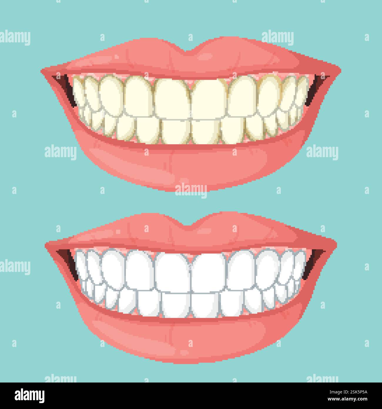 Illustration showing teeth whitening transformation Stock Vector Image ...