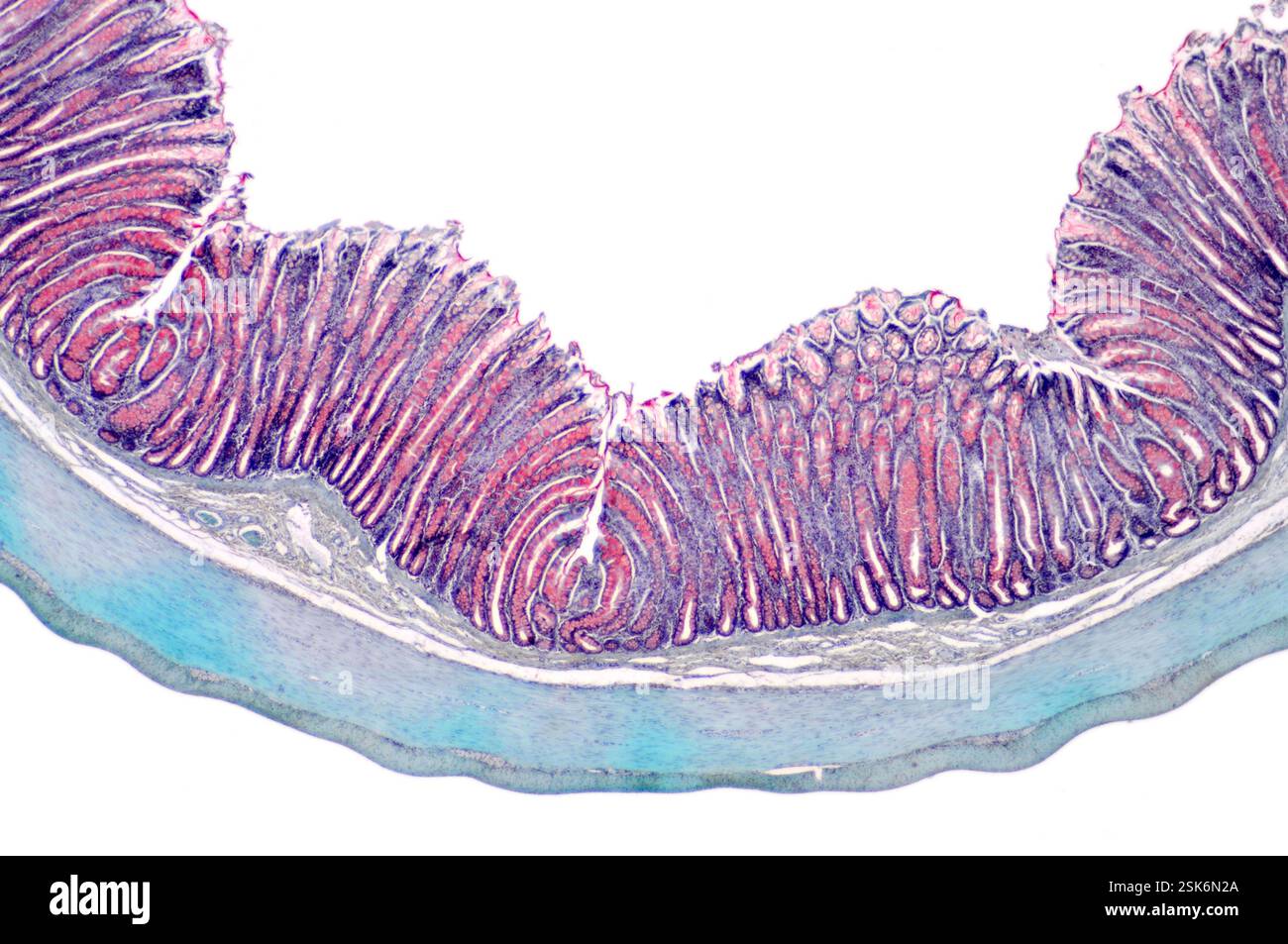 Colon. Light micrograph of a section through the large intestine, or ...