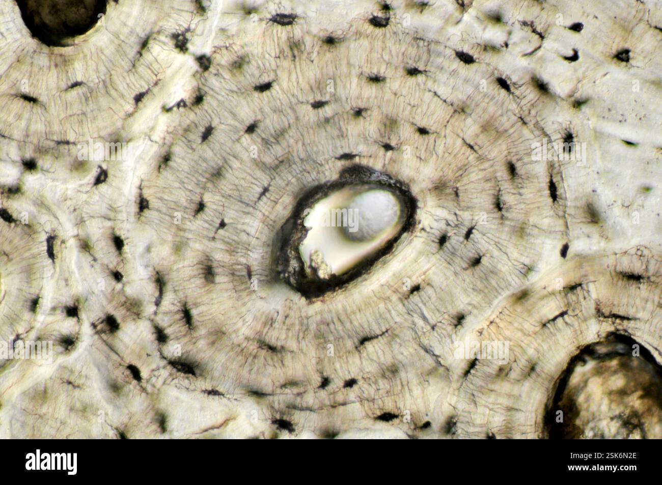 Compact bone, polarised light micrograph. Compact bone consists of concentric layers of collagen ...