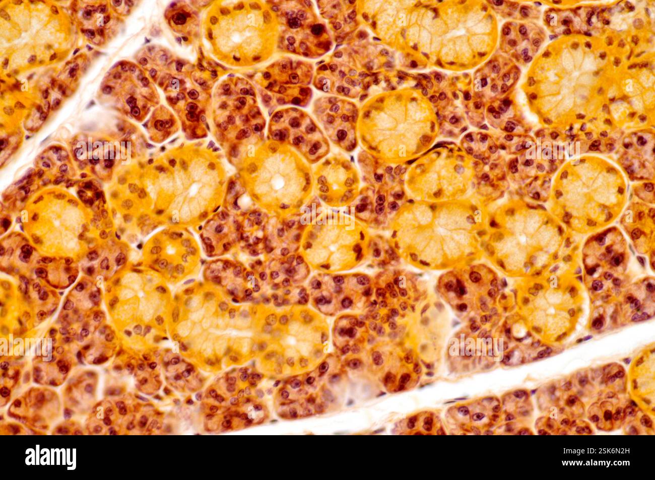 Salivary gland. Light micrograph of a section through a salivary gland ...