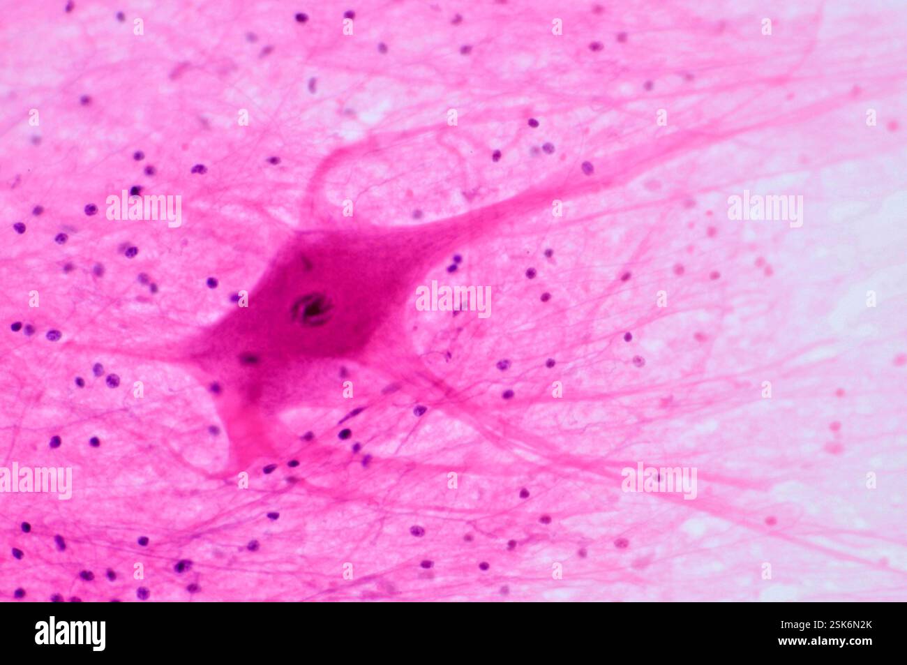 Multipolar neuron. Light micrograph of a multipolar nerve cell (neuron ...