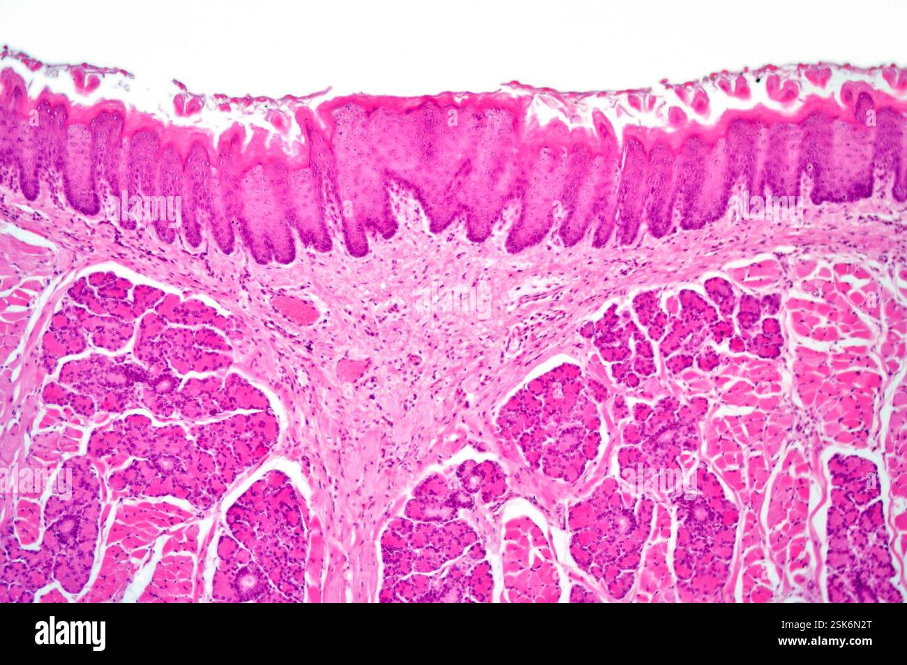 Tongue. Light micrograph of a section through healthy tongue tissue ...