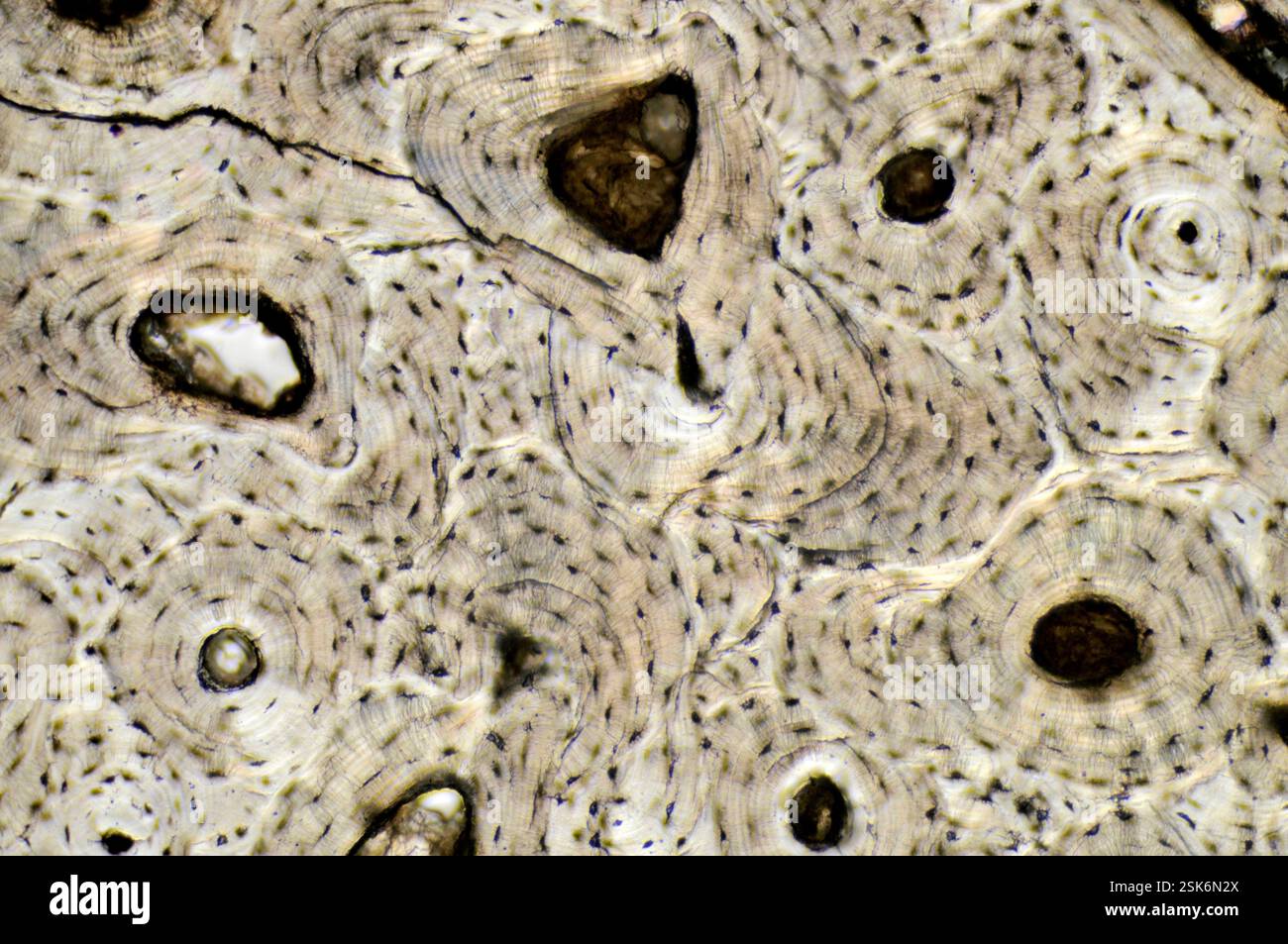 Compact bone, polarised light micrograph. Compact bone consists of ...