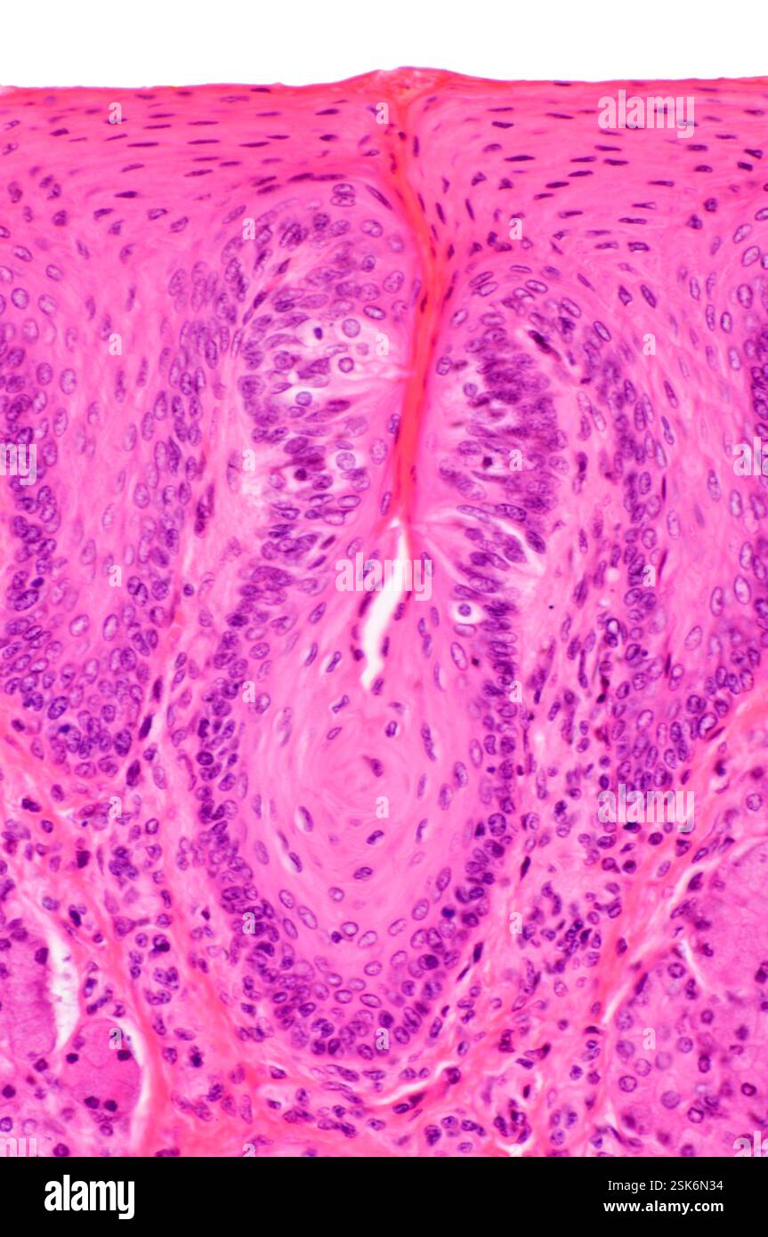 Taste bud. Light micrograph of a section through a tongue showing a ...