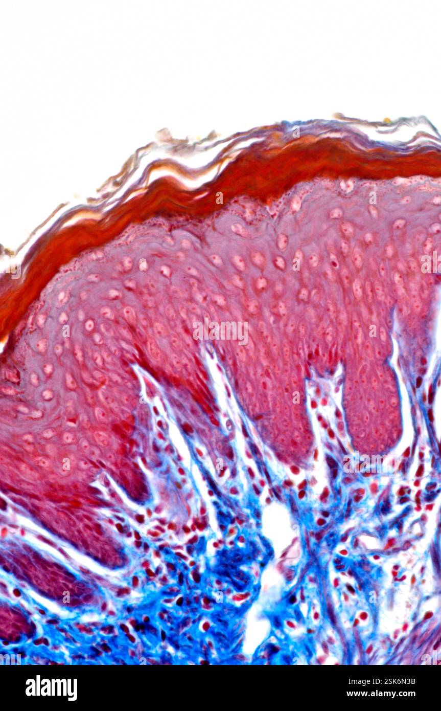 Stomach wall. Light micrograph of a section through the stomach at the ...