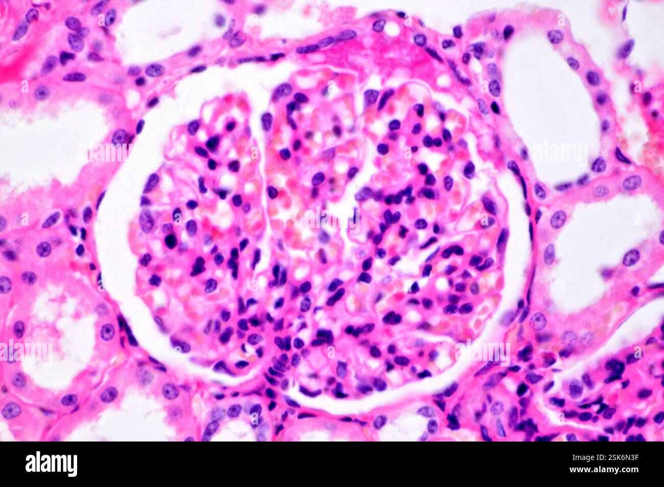Kidney glomerulus. Kidney glomerulus, light micrograph. This section ...