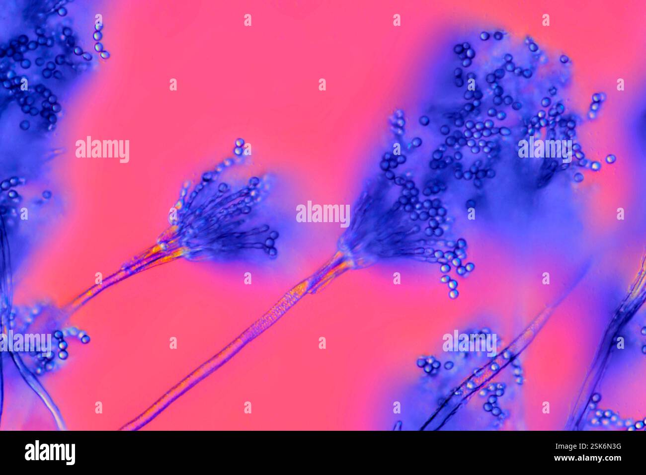 Penicillium sp. fungus, differential interference contrast (DIC) light ...