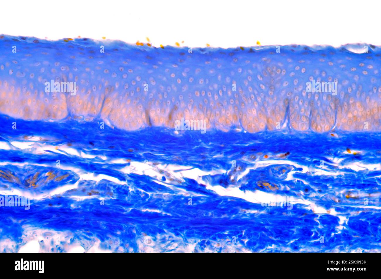 Epiglottis. Light micrograph of a section through the epiglottis, the ...