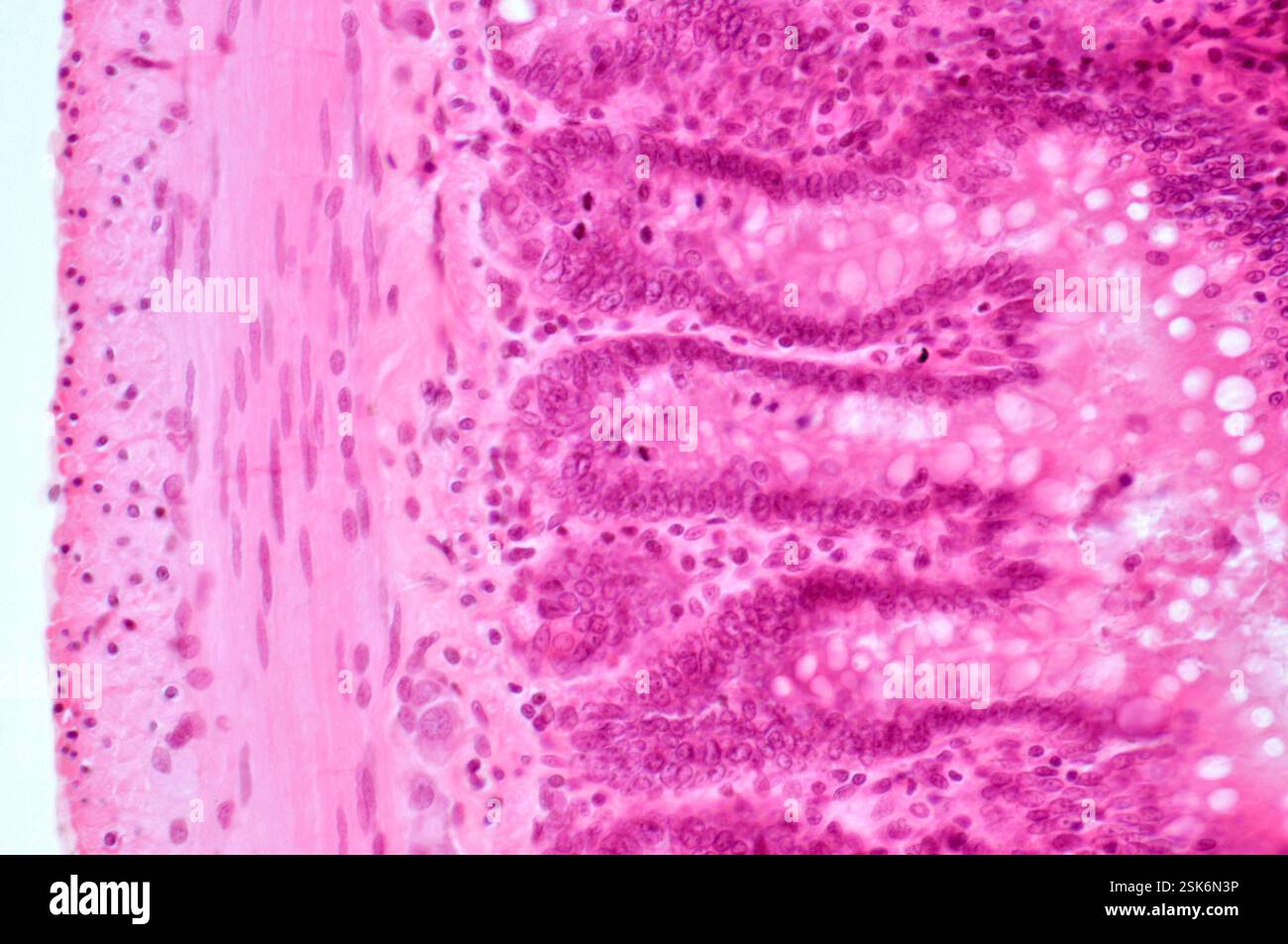Small intestine, light micrograph. At left are layers of muscle that ...