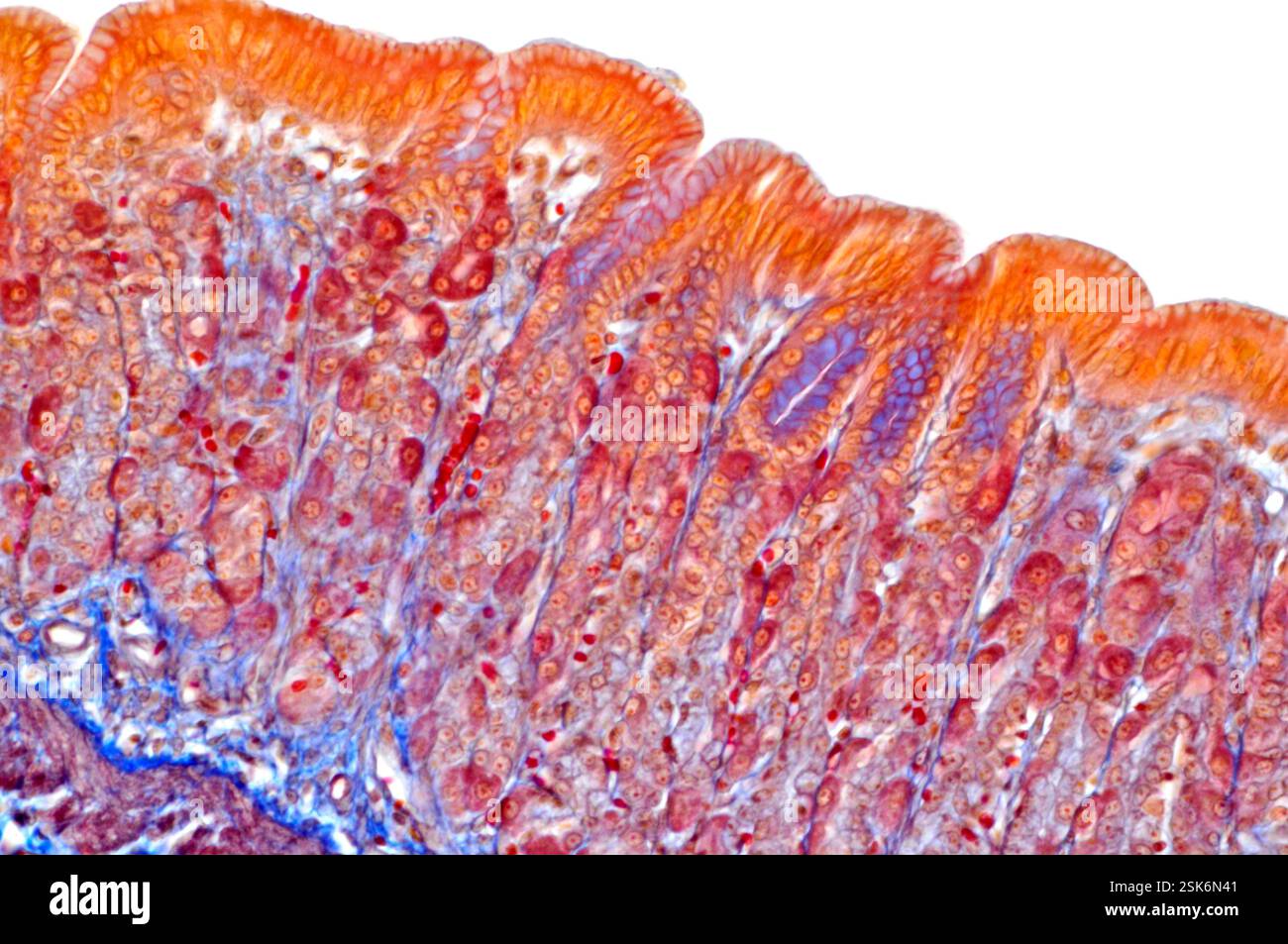 Stomach wall. Light micrograph of a section through the stomach. The ...