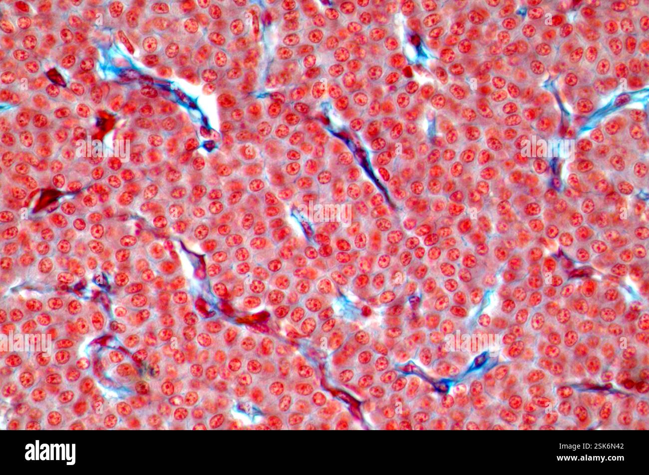 Parathyroid gland, light micrograph. The blue structures are ...