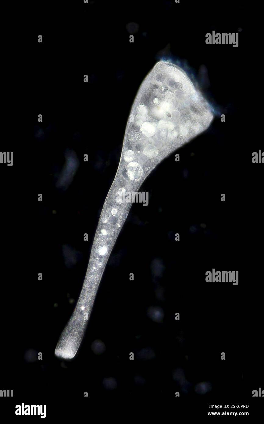 Stentor protozoan. Light micrograph of a section through a Stentor sp ...