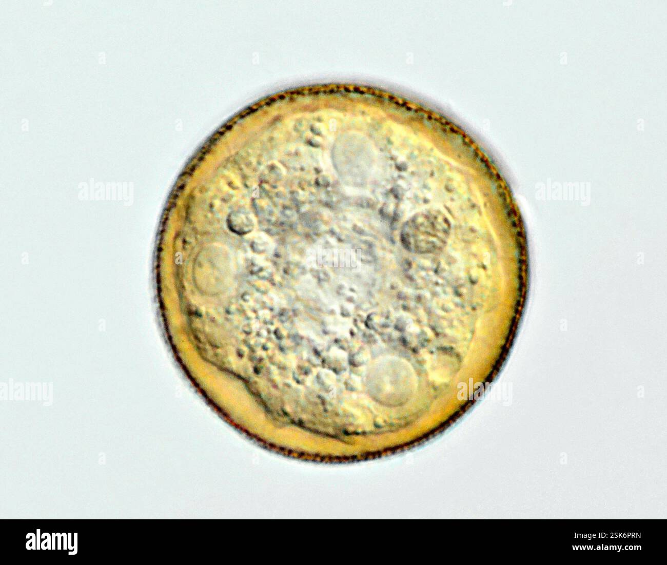 Shelled amoeba. Differential interference contrast (DIC) light micrograph of an Arcella sp ...