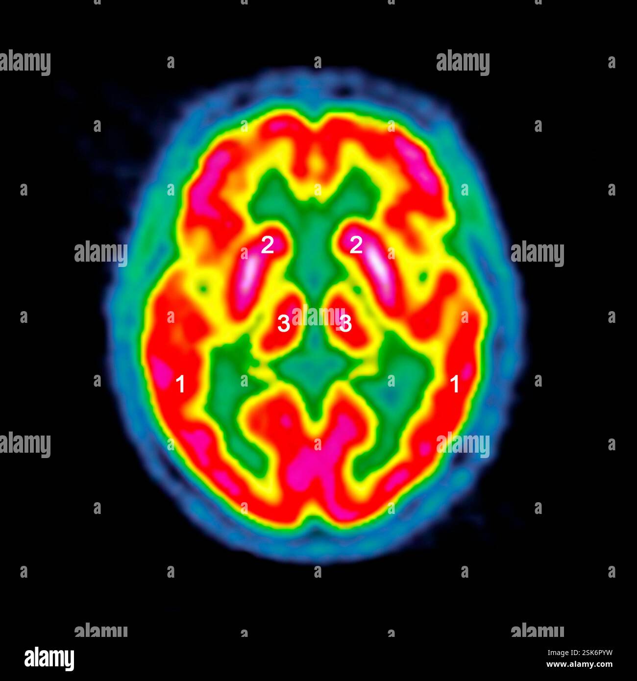 Normal brain activity. Coloured positron emission tomography (PET) scan of an axial section ...