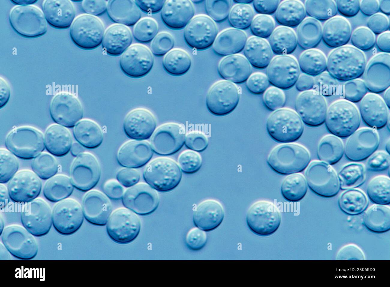 Brewer's yeast (Saccharomyces cerevisiae), light micrograph using ...