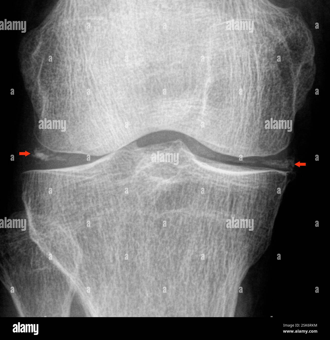 Pemphigus foliaceus lesions Stock Photo - Alamy
