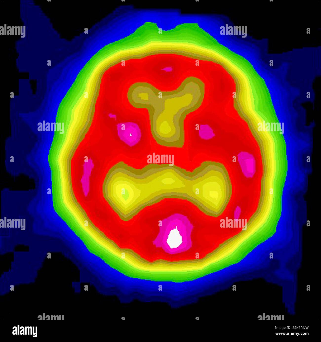 Healthy brain. Coloured single photon emission computed tomography (SPECT) scan of an axial ...