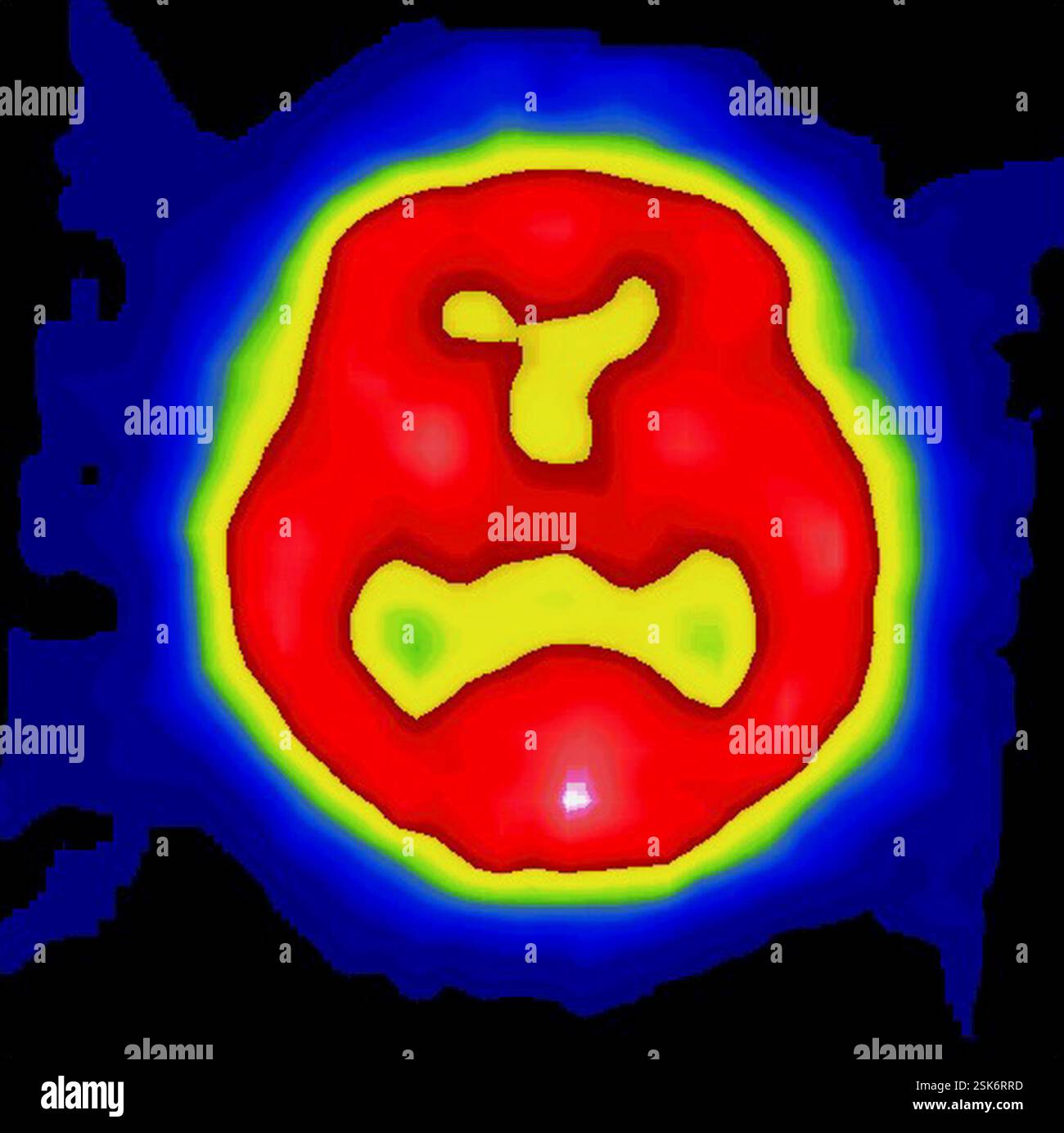 Healthy brain. Coloured single photon emission computed tomography ...