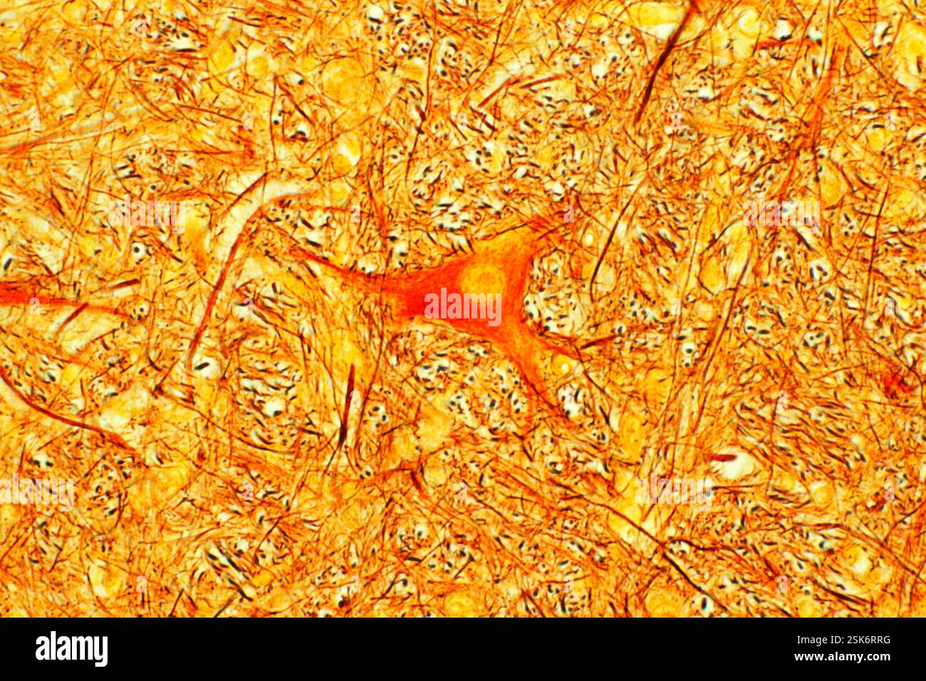 Nerve cell. Light micrograph of a nerve cell (neurone) from the brain ...