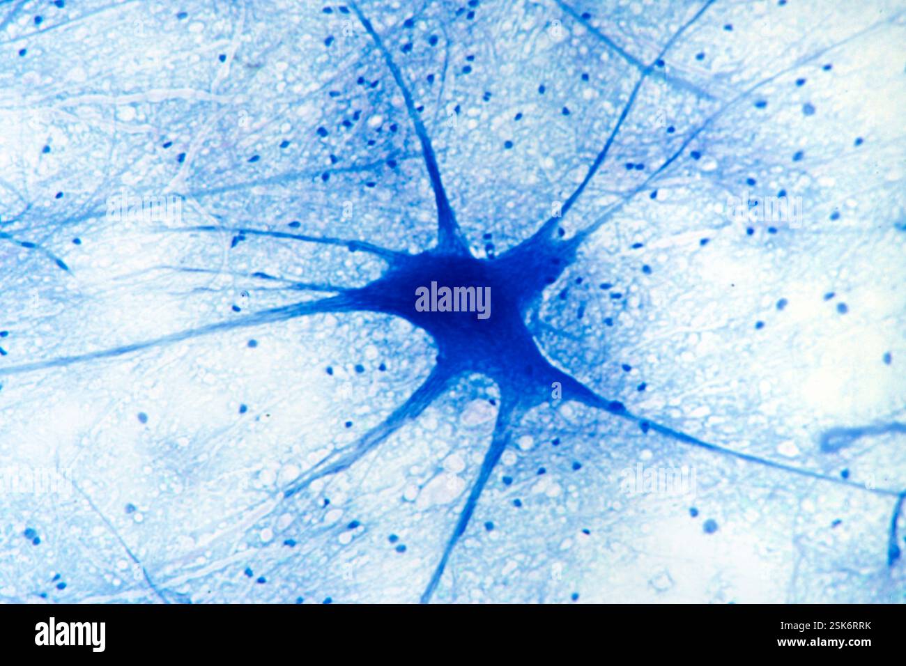 Motor neurone. Light micrograph of a motor neurone (nerve cell) from ...