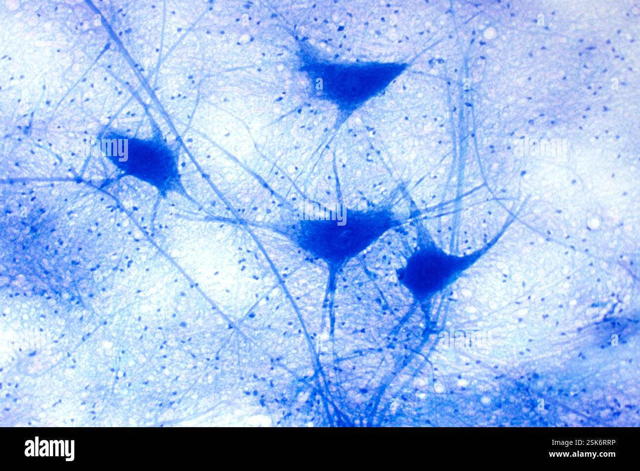 Motor neurones. Light micrograph of motor neurones (nerve cells) from ...