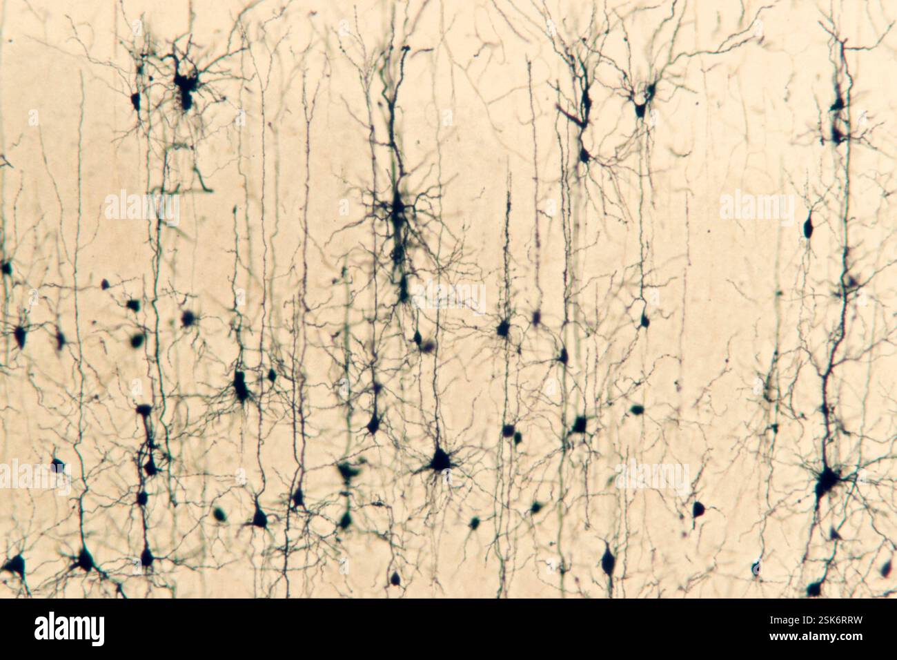 Pyramidal nerve cells Stock Photo - Alamy