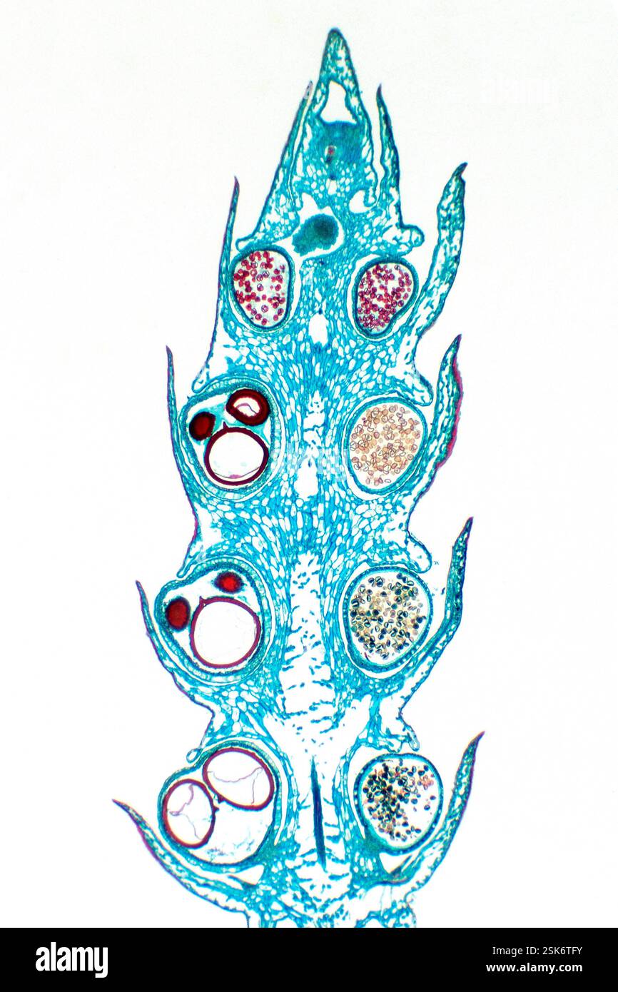 Selaginella sp. moss strobilus, light micrograph. The strobilus is the spore-bearing structure ...