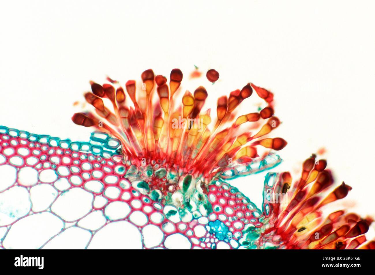 Wheat rust. Light micrograph of wheat rust fungus (Puccinia graminis ...