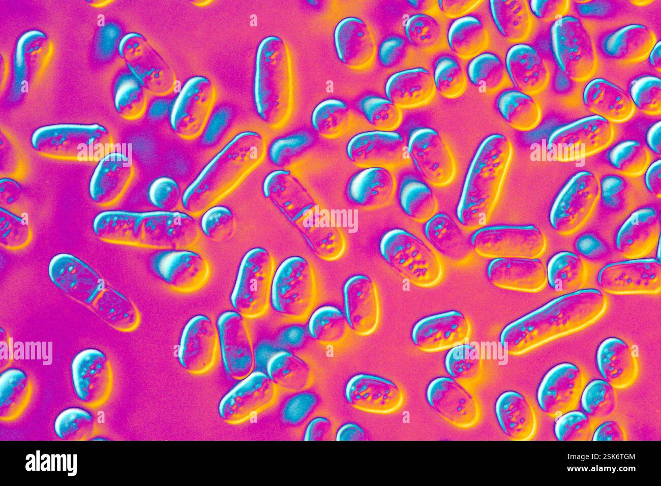 Yeast (Saccharomyces pombe) dividing, light micrograph using ...