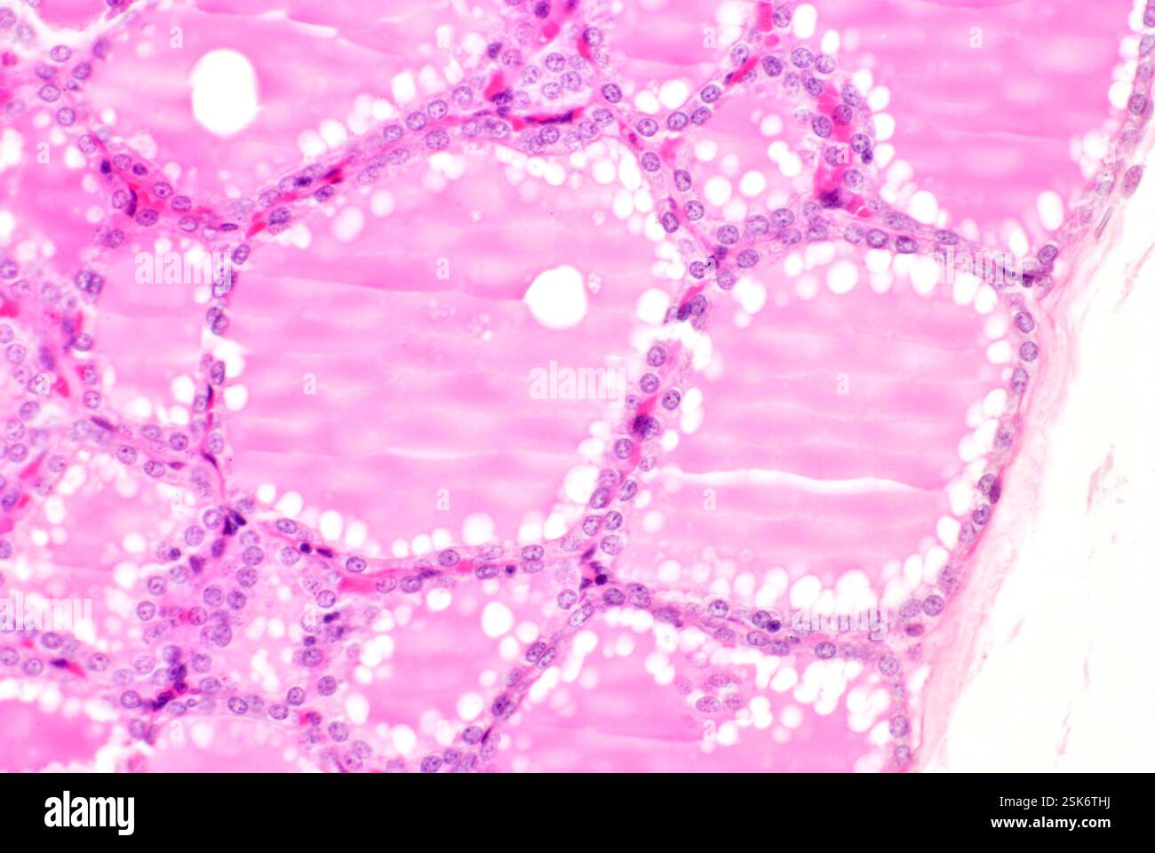 Thyroid gland tissue, light micrograph. This is tissue from a healthy ...