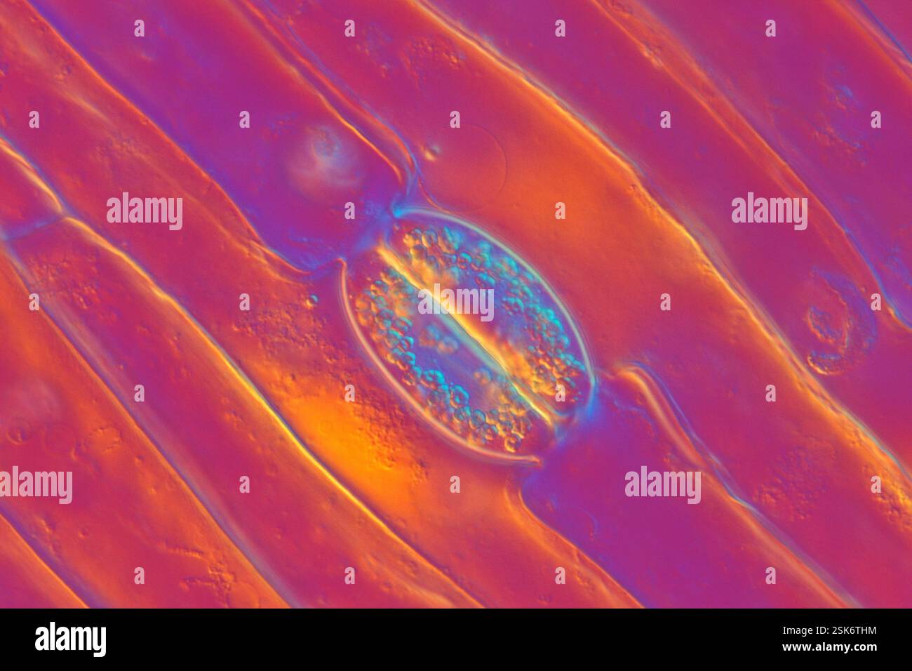 Closed stoma, light micrograph. This structure (oval) is a pore that ...