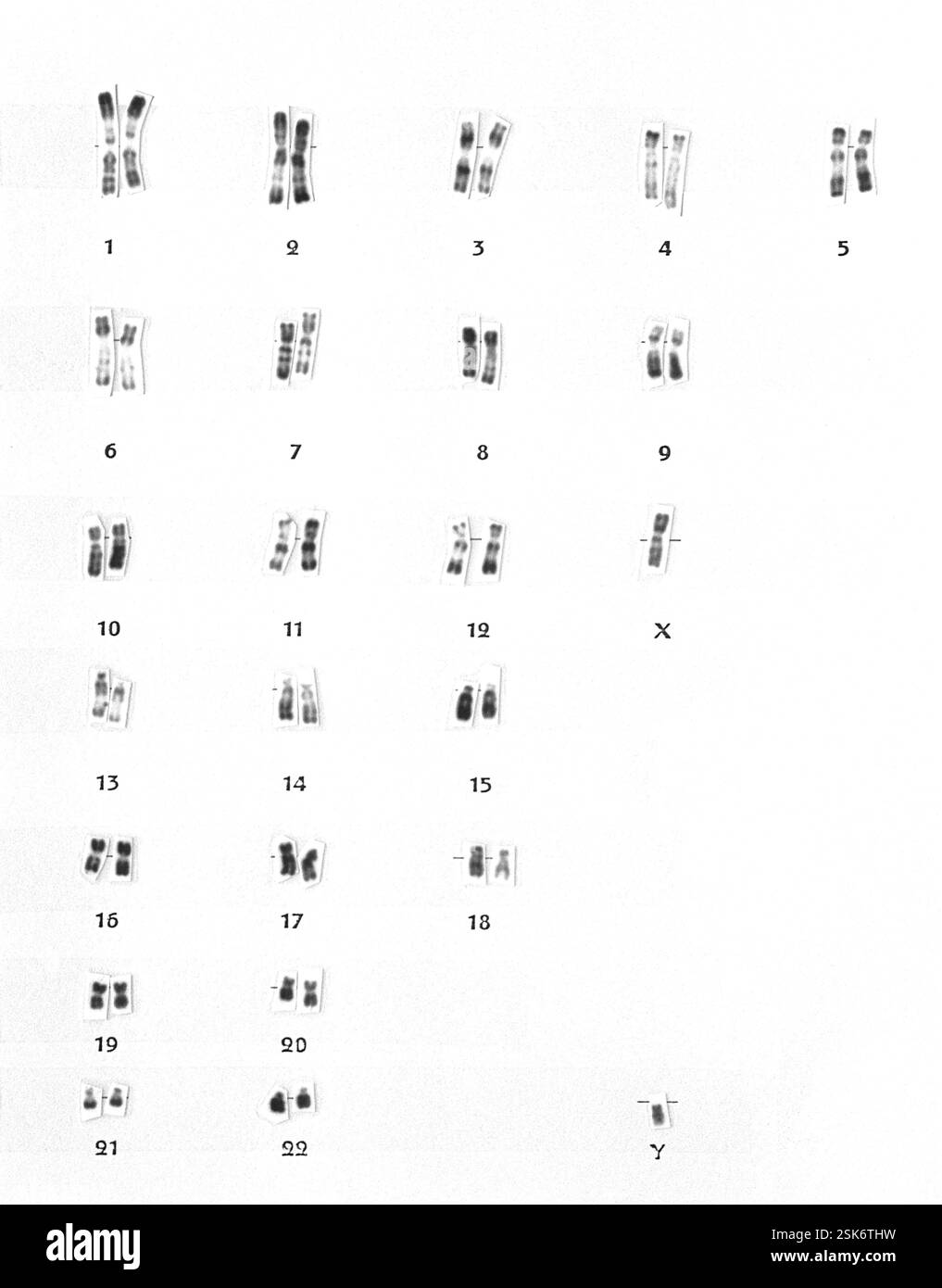 Sea urchin embryo development Stock Photo - Alamy