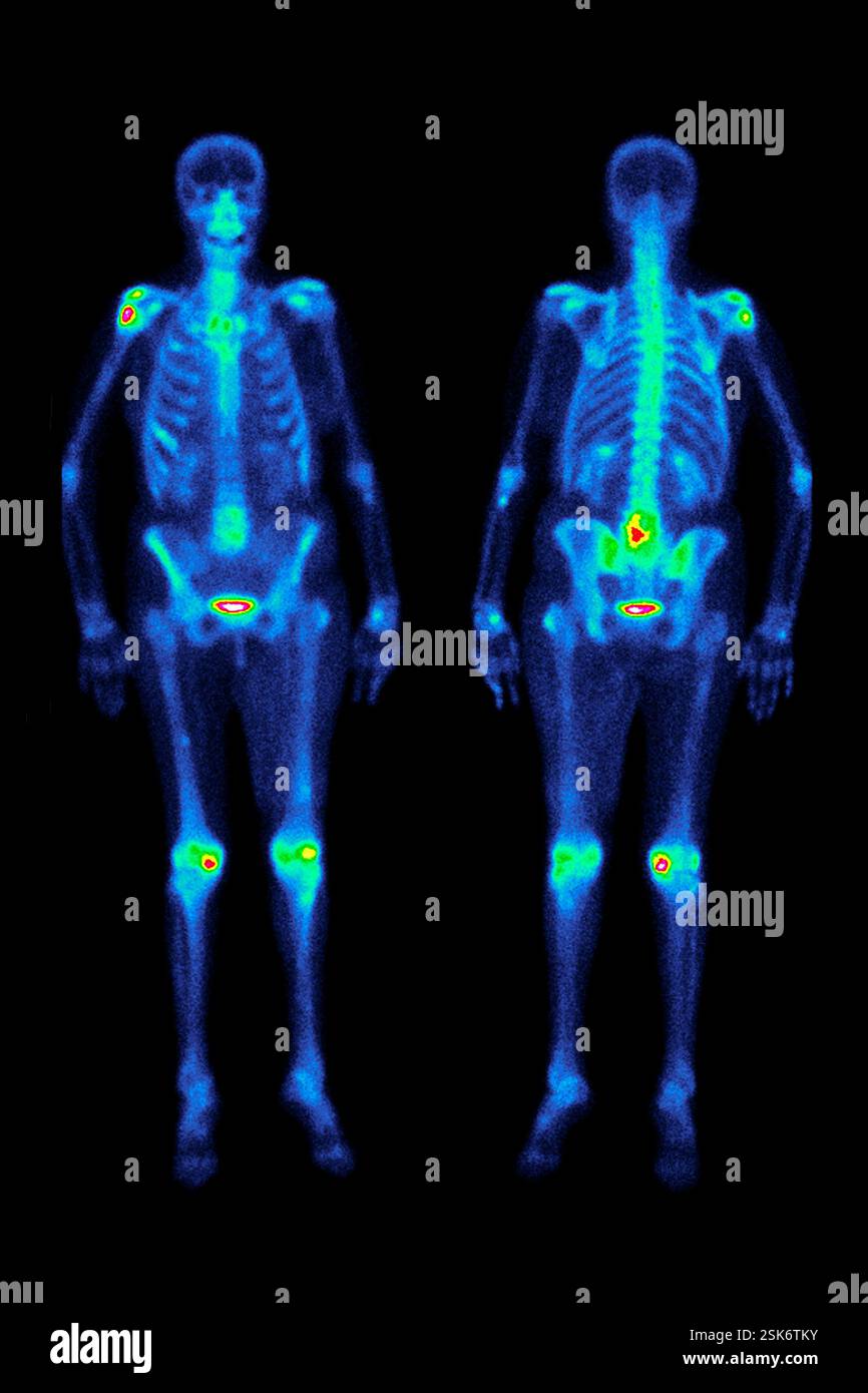 Blood vessel deformities, MRI scan Stock Photo - Alamy
