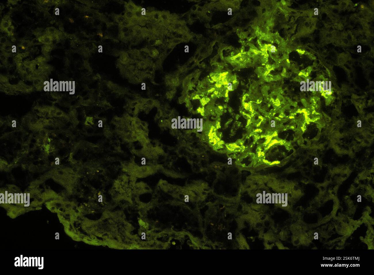 Pyramidal nerve cells Stock Photo - Alamy